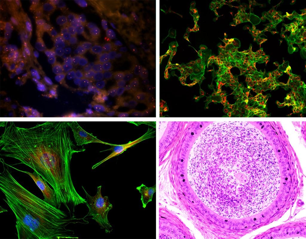 ¿Cómo Seleccionar su Microscopio Óptico?